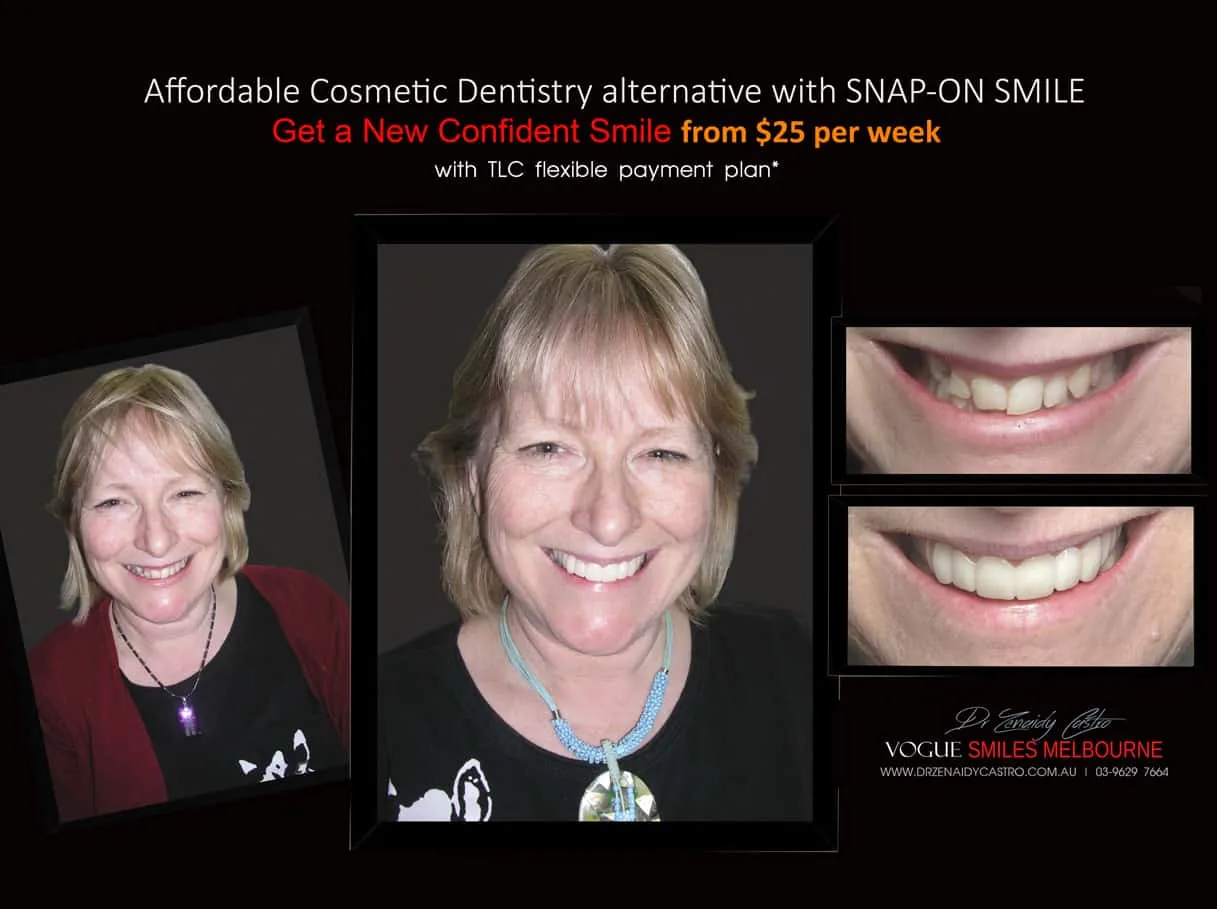 Most Affordable Way to Improve Your Smile | From $25/week