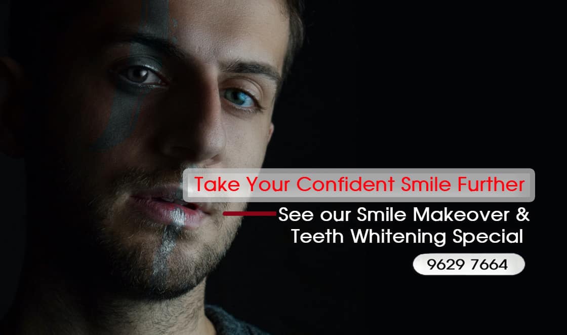 Porcelain Veneers Cost in Melbourne